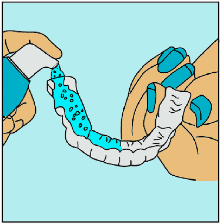 OAP Cleaner: An Easy & Effective Way to Clean All Oral Appliances ...